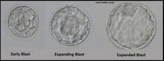 Embryo Development - Insight into the IVF Lab