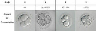 Embryo Development - Insight into the IVF Lab