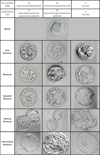 Embryo Development - Insight into the IVF Lab